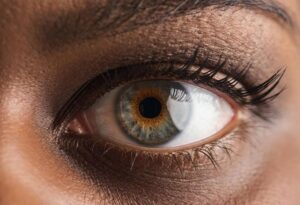 Why Are There Starbursts In My Vision? | Milan Eye Center